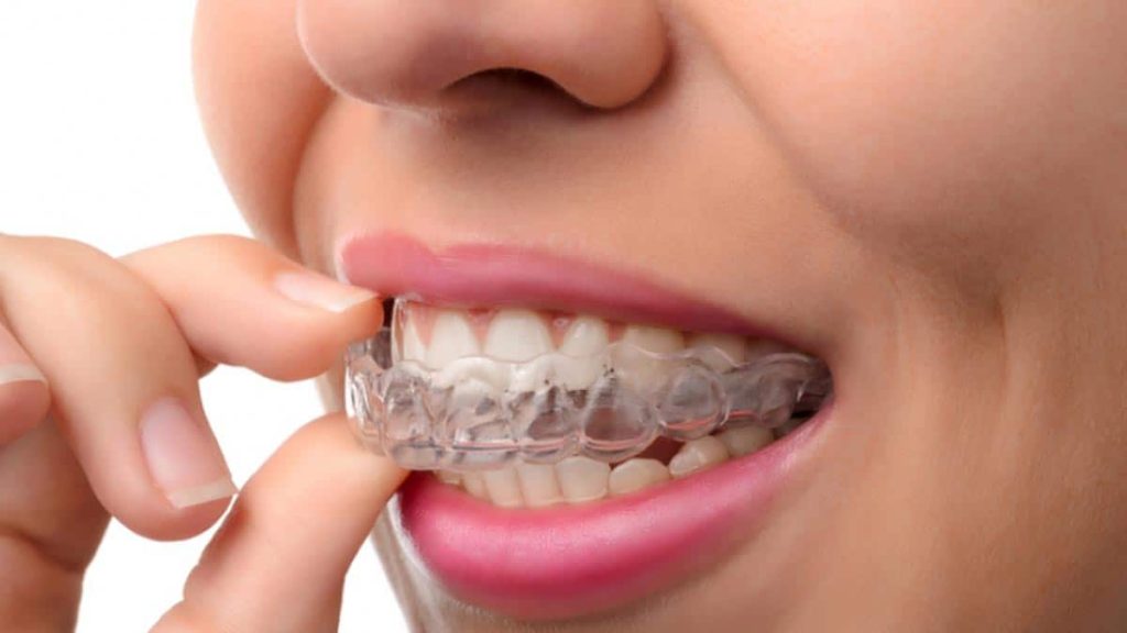 Receding Gums - Symptoms, Causes and Treatment - 7 Dimensions Medical ...